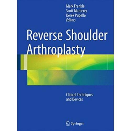 Reverse Shoulder Arthroplasty: Biomechanics, Clinical Techniques, | Extra